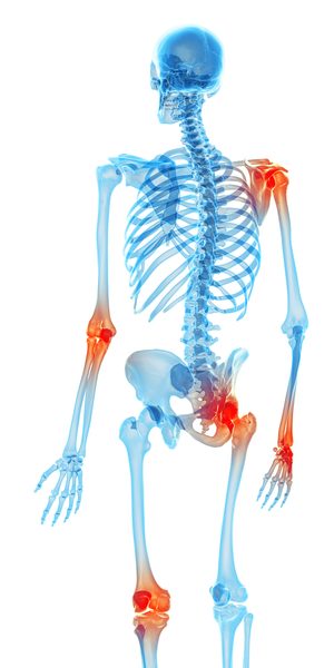 Interventional Pain Management | Airport Plaza Spine Wellness | #1 Pain ...